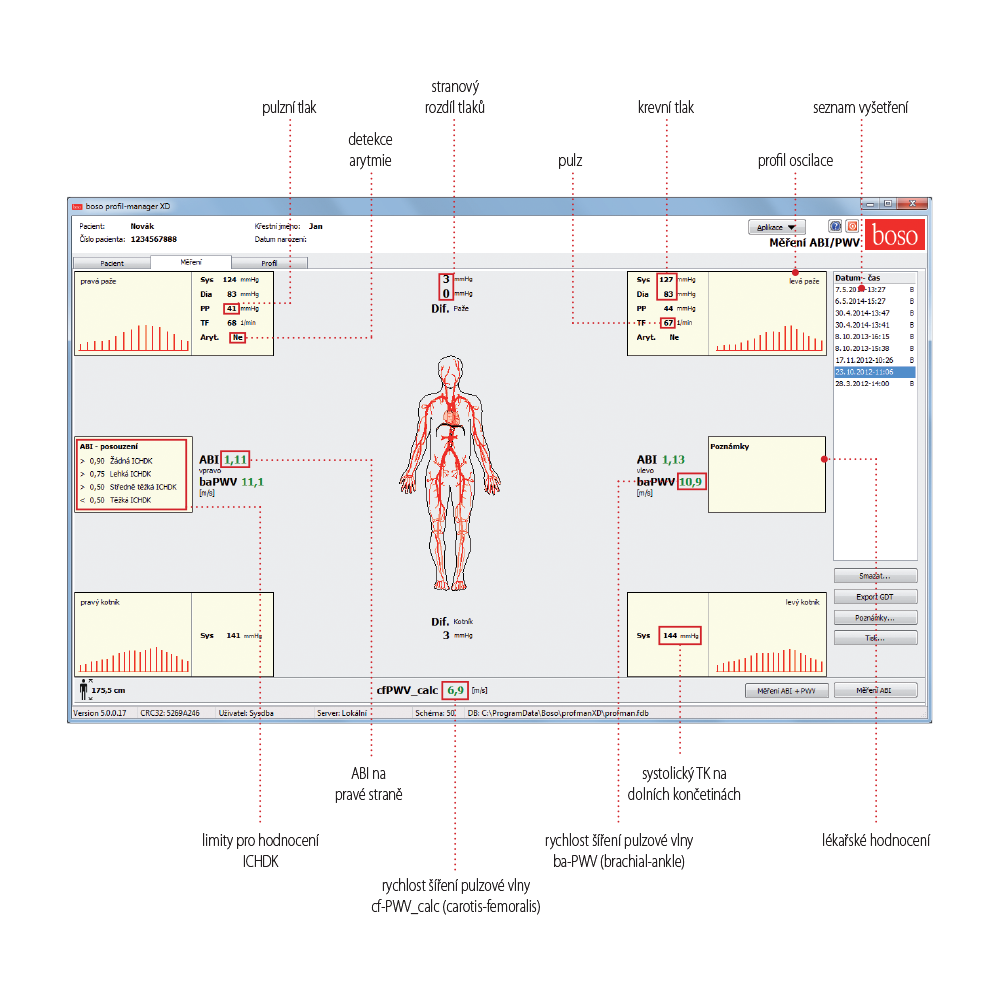 Boso ABI-systém 100 - měření kotníkových tlaků - COMPEK MEDICAL ...