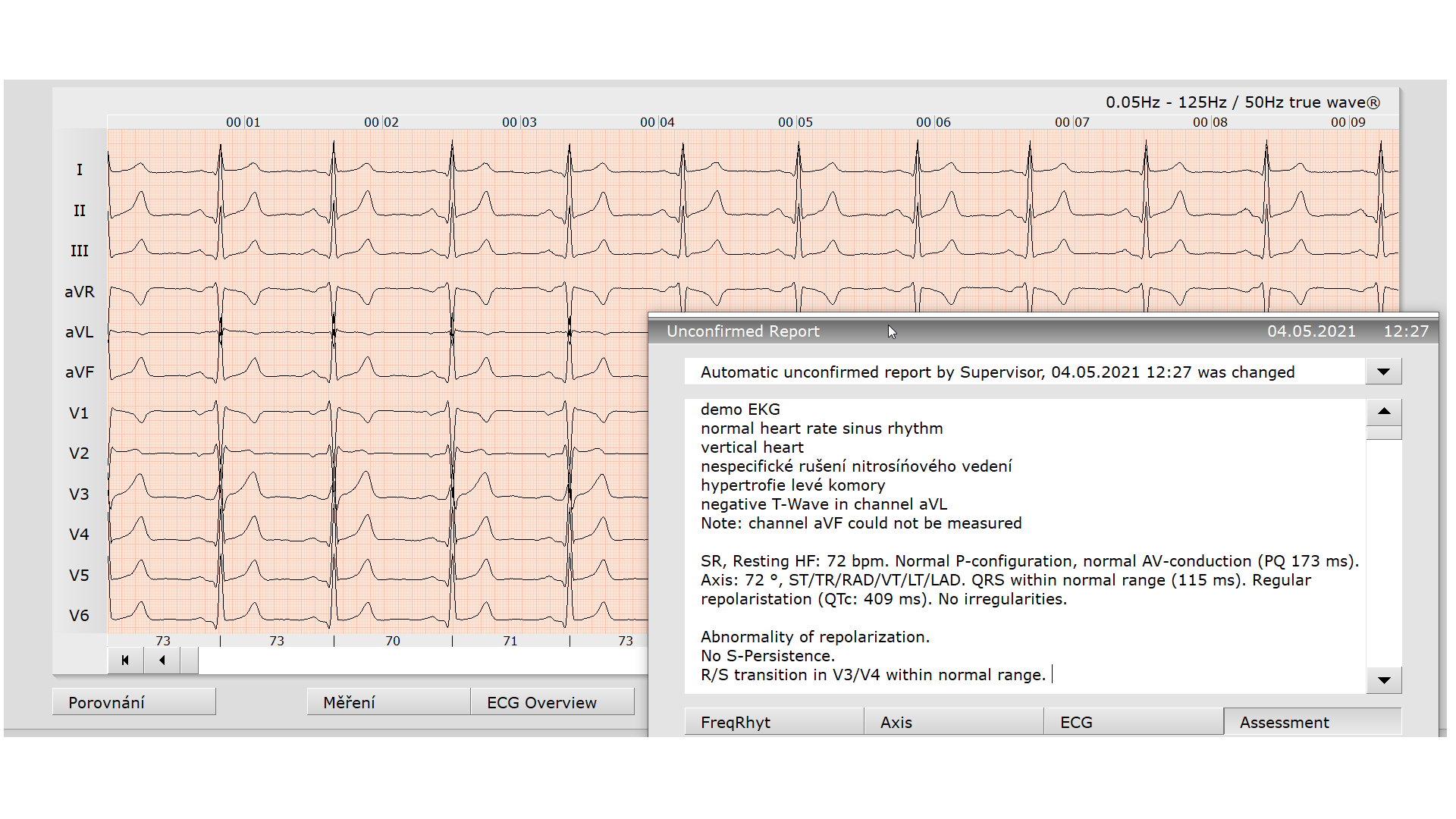 Modul Interpretace a srdeční variability pro EKG Custo - COMPEK MEDICAL ...