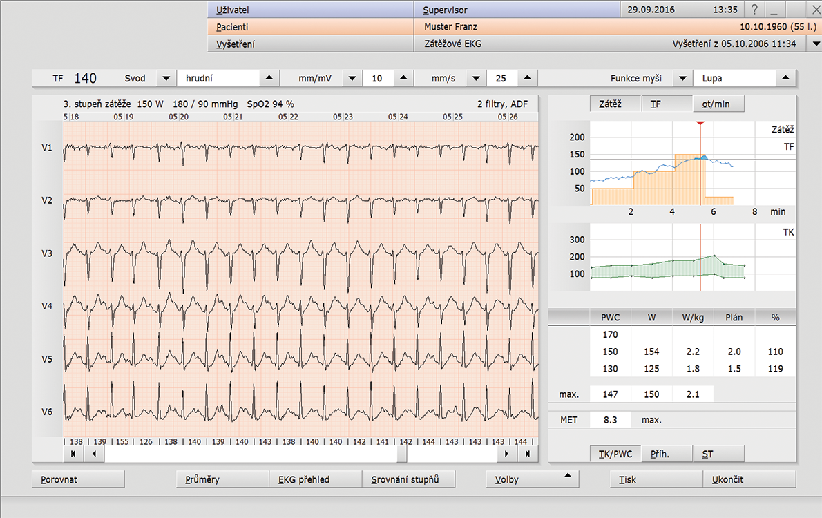 MetaSoft Studio - rozhraní pro 12kanálové EKG - COMPEK MEDICAL SERVICES ...