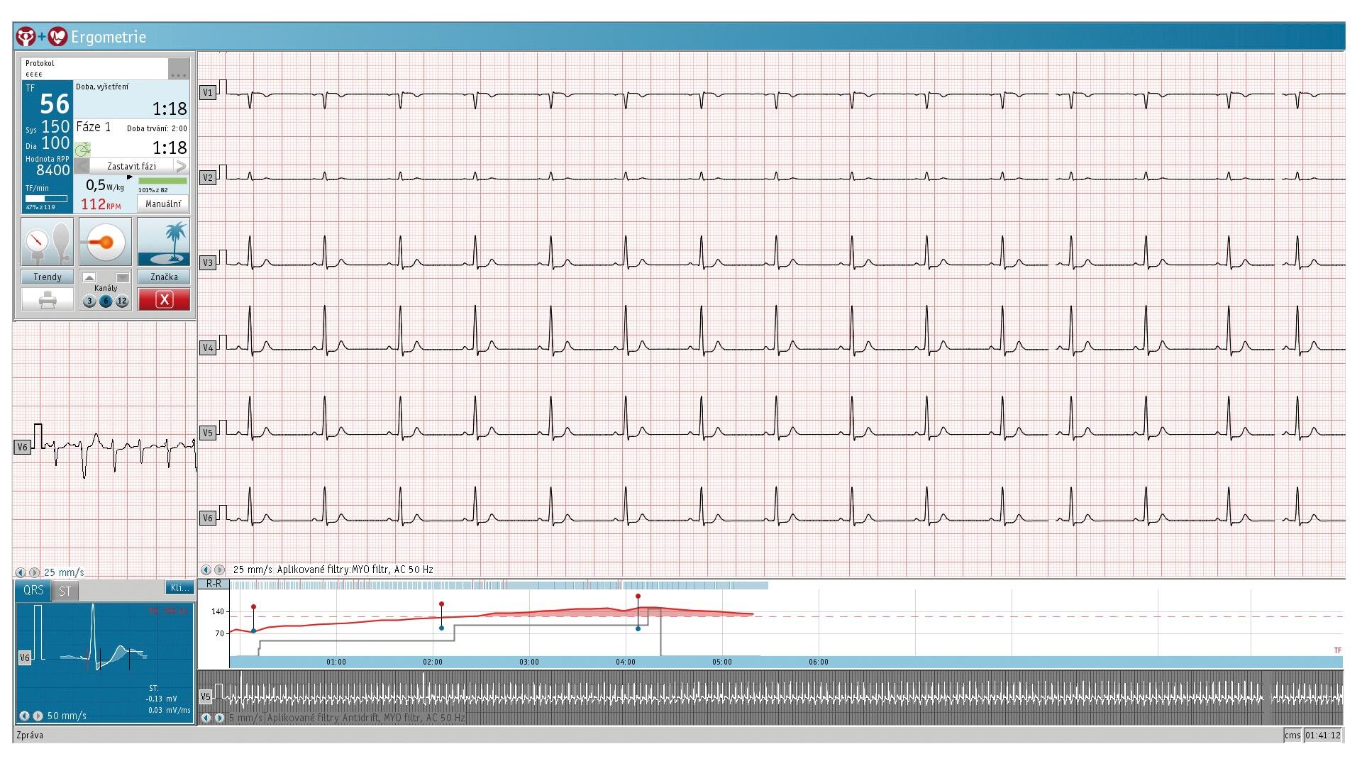Zátěžové + klidové BLUETOOTH PC-EKG PADSY (ECG Top BT) - COMPEK MEDICAL ...