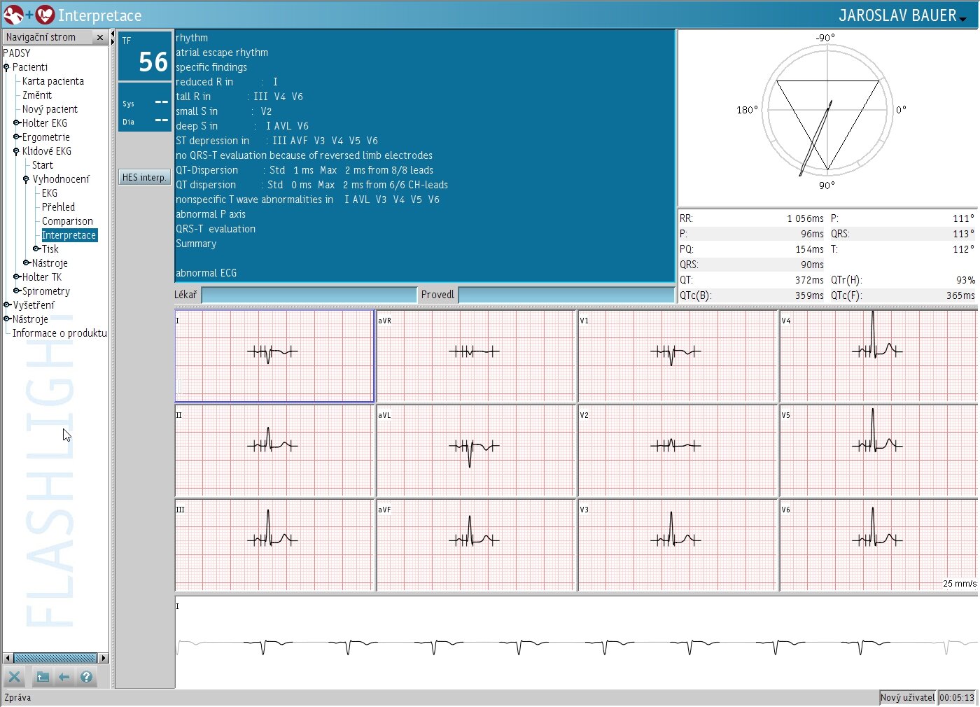 Modul slovní interpretace HES analýzy EKG záznamu - COMPEK MEDICAL ...